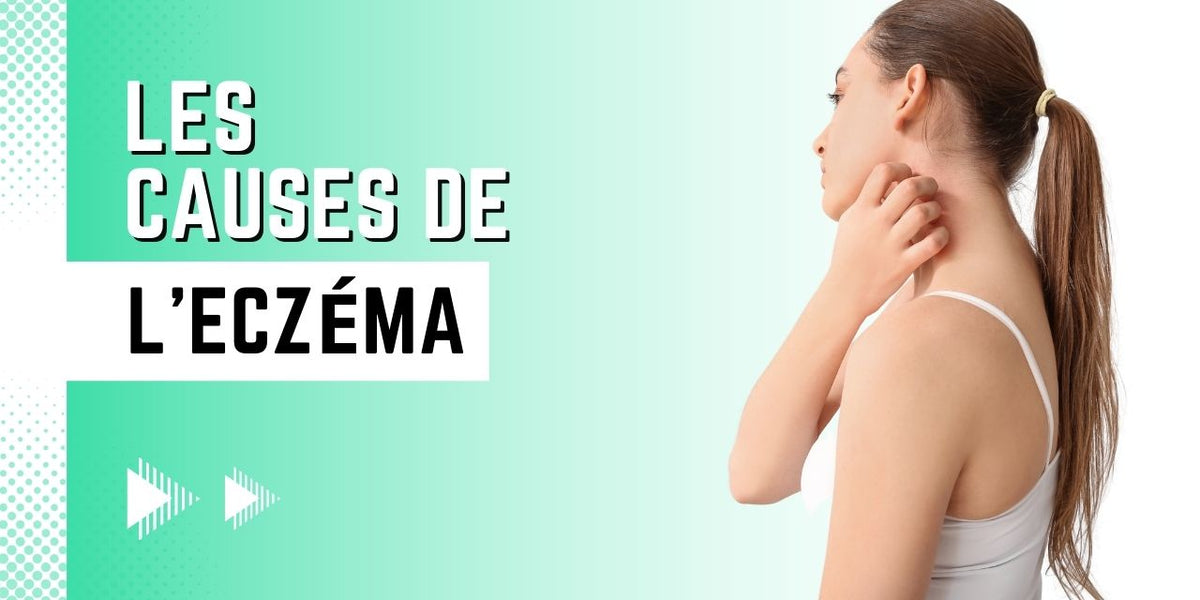 Les causes de l'eczéma